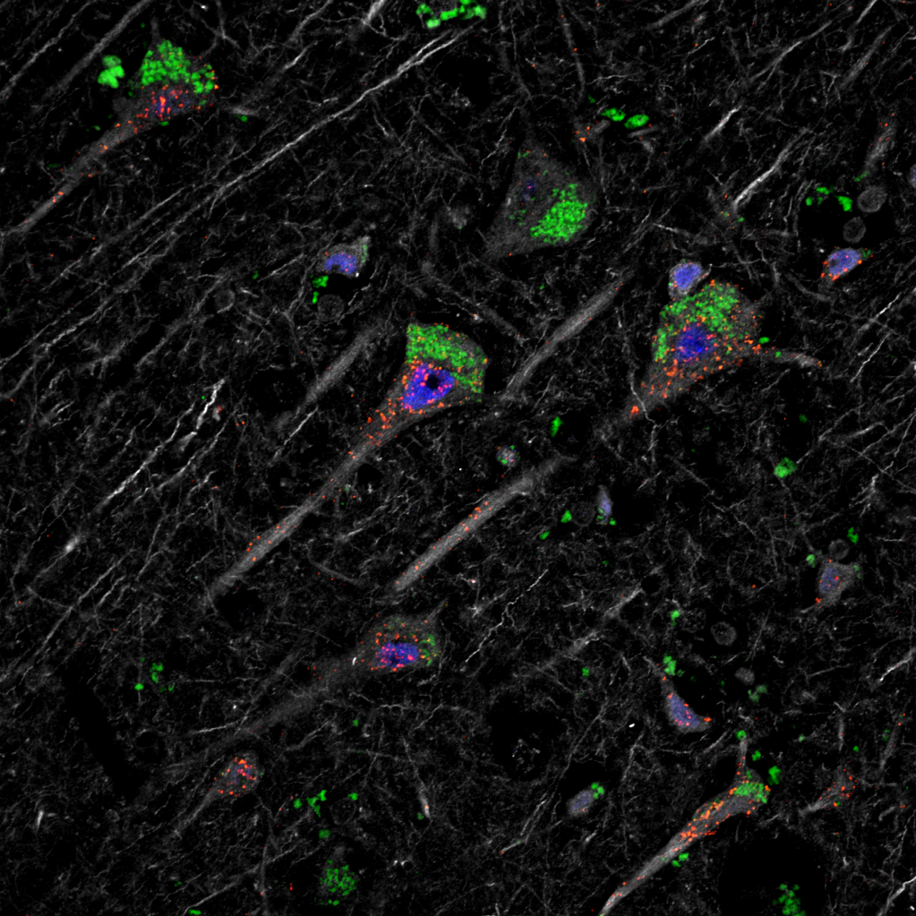 Fundraiser – miRcore